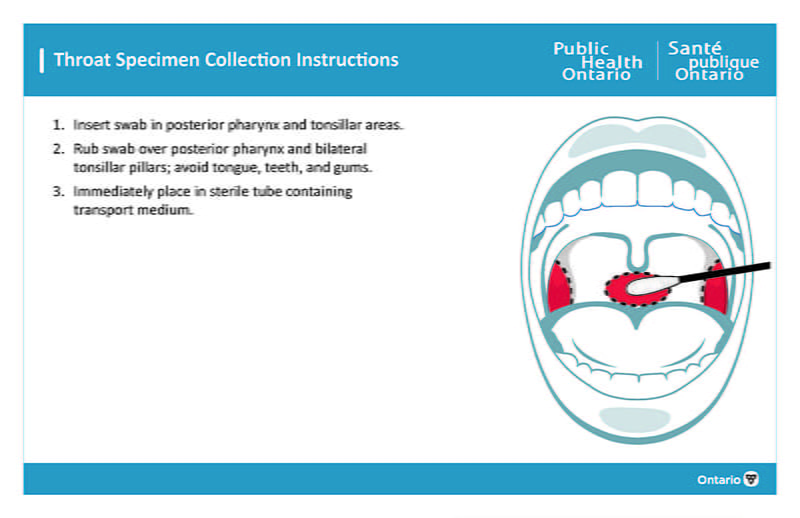 Virus Respiratory (Throat) Specimen Collection Instructions | Santé ...