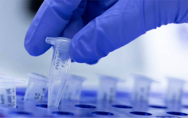 Explained: COVID-19 PCR Testing and Cycle Thresholds | Public Health ...