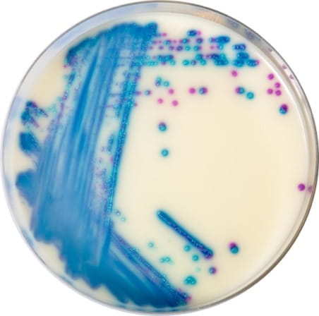 Vancomycin-Resistant Enterococcus (VRE) Program of Research | Public ...