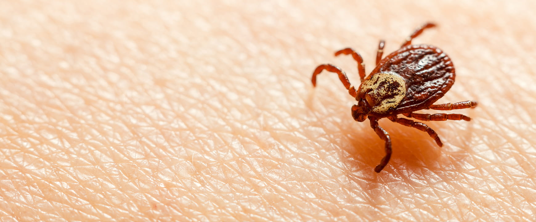Rocky Mountain spotted fever | Public Health Ontario